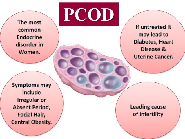 PCOD Treatment in Vasant Kunj, Delhi